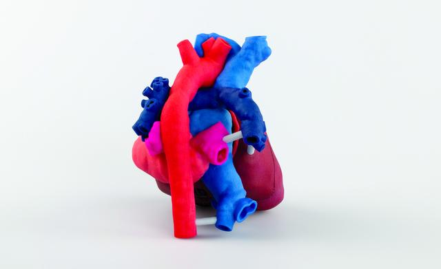 3D Systems, Inc. - 3D Systems’ Medical Workflow Enables OpHeart’s ...